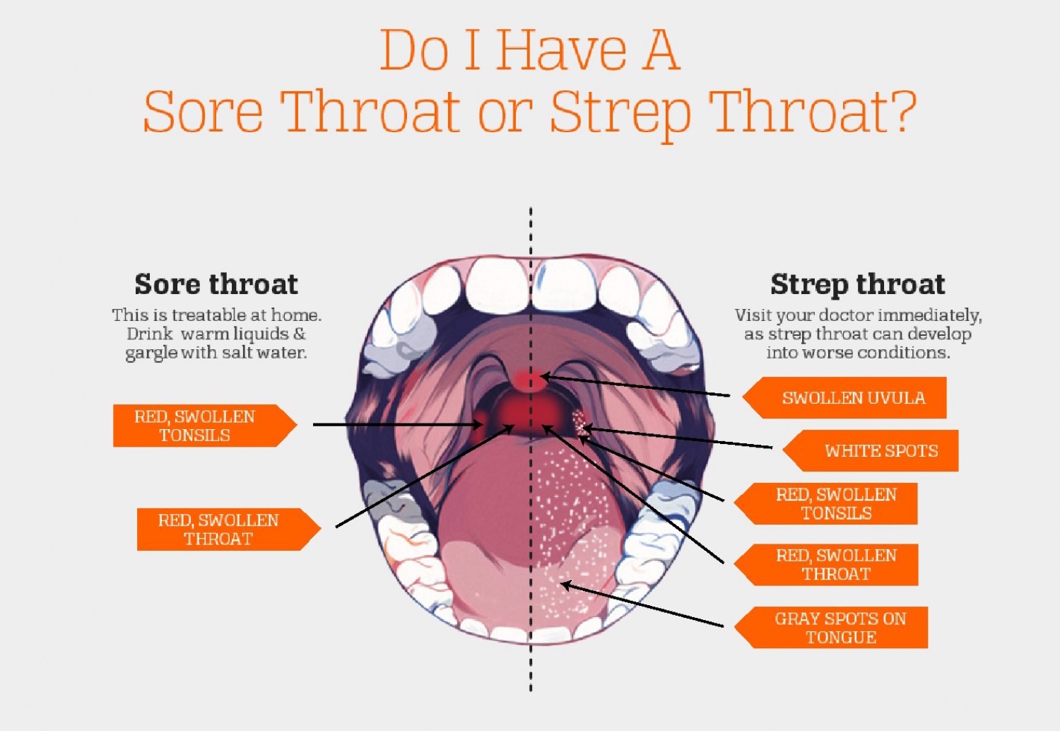 Sore Throat Diagram