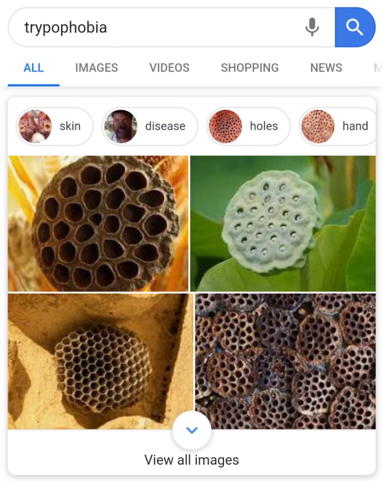 Trypophobia Skin Disease