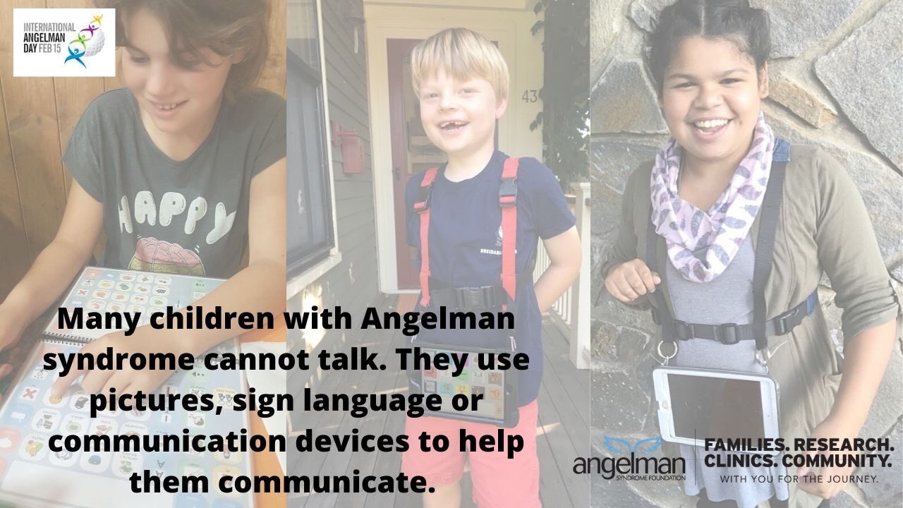 Angelman Syndrome Signs