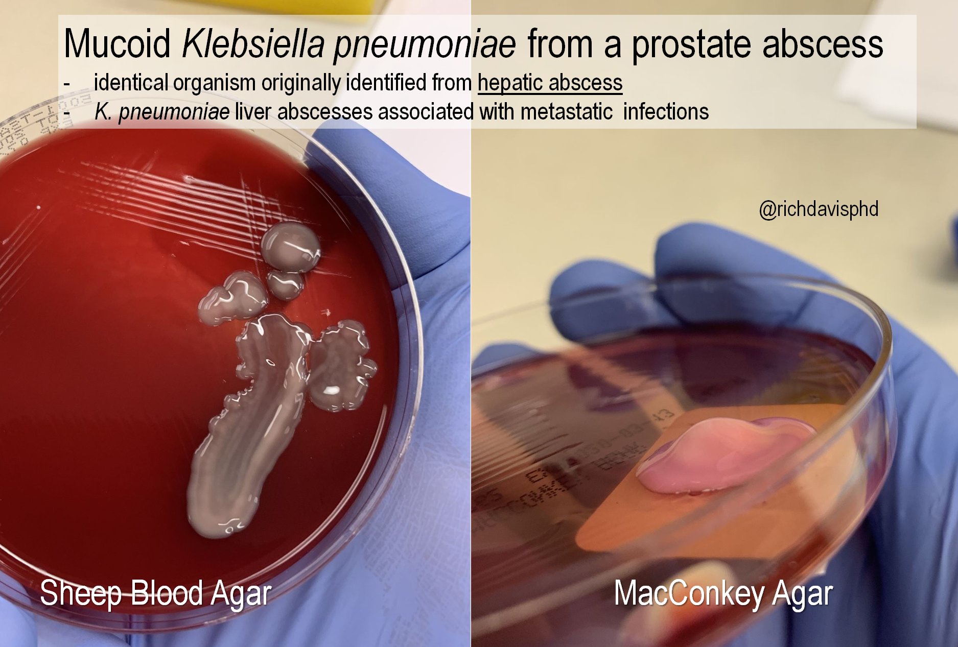 Klebsiella Pneumoniae Morphology
