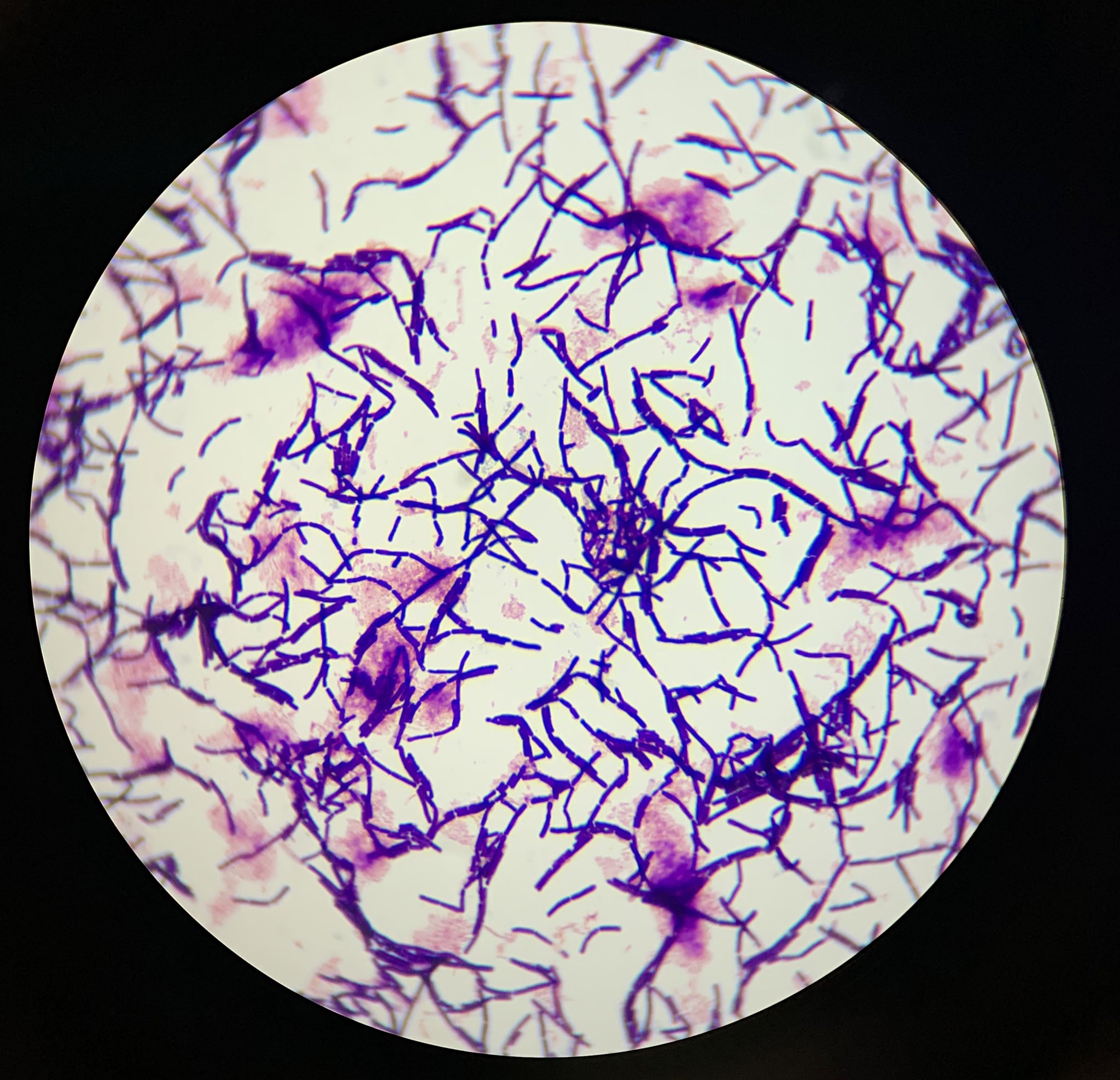 Bacteria Under Compound Microscope How To See BACTERIA With A