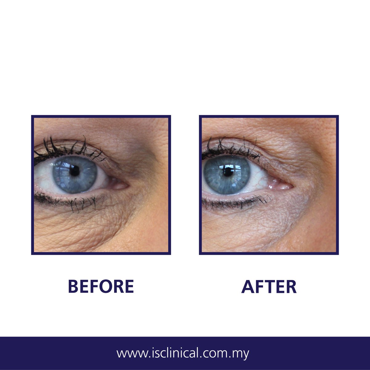 Is clinical youth eye complex - munimoro.gob.pe