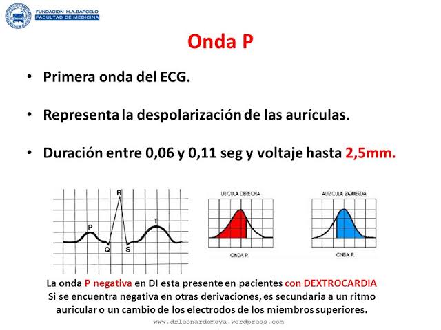 Manual obvio Preconcepción onda p despolarizacion auricular Interpretar ...