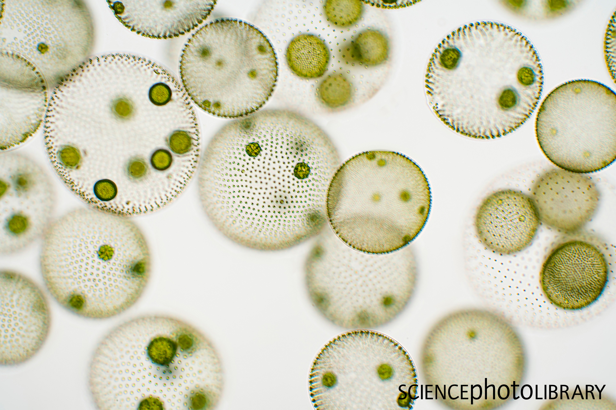 Volvox 100x Swimming Ability And Flagellar Motility Of Sperm Packets