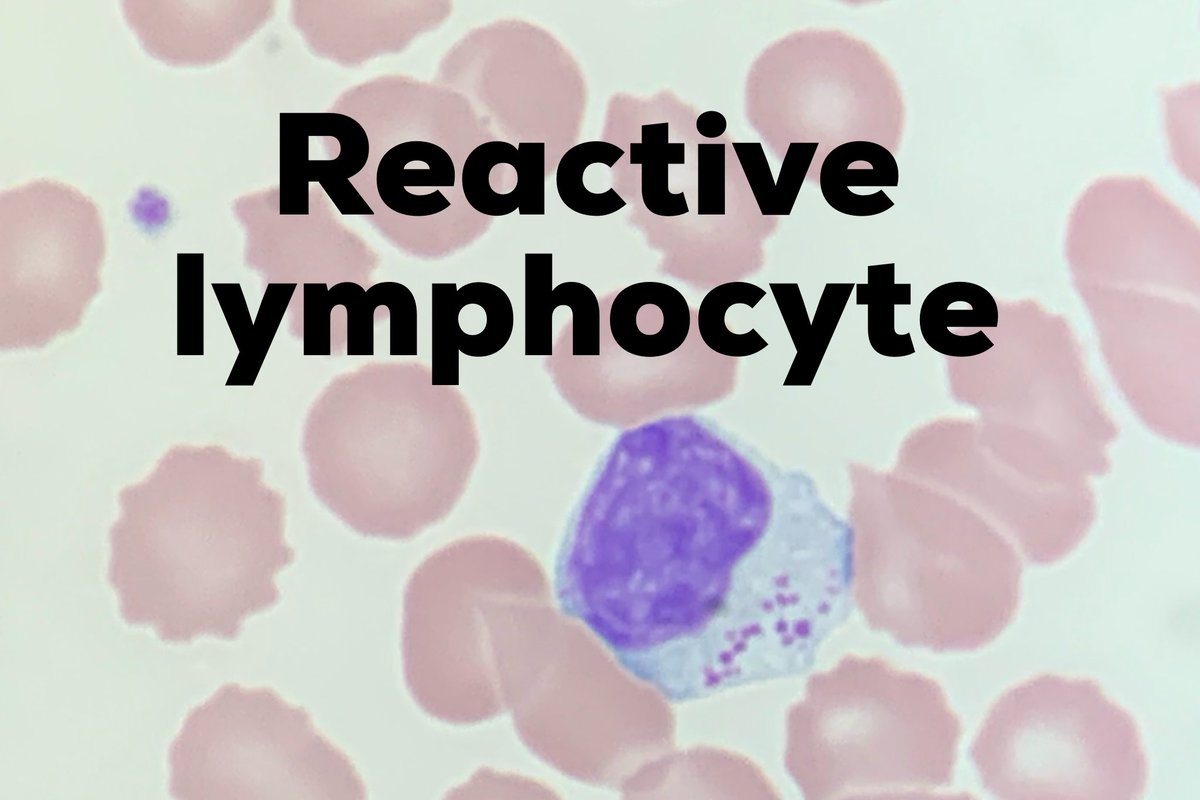 Reactive Lymphocyte