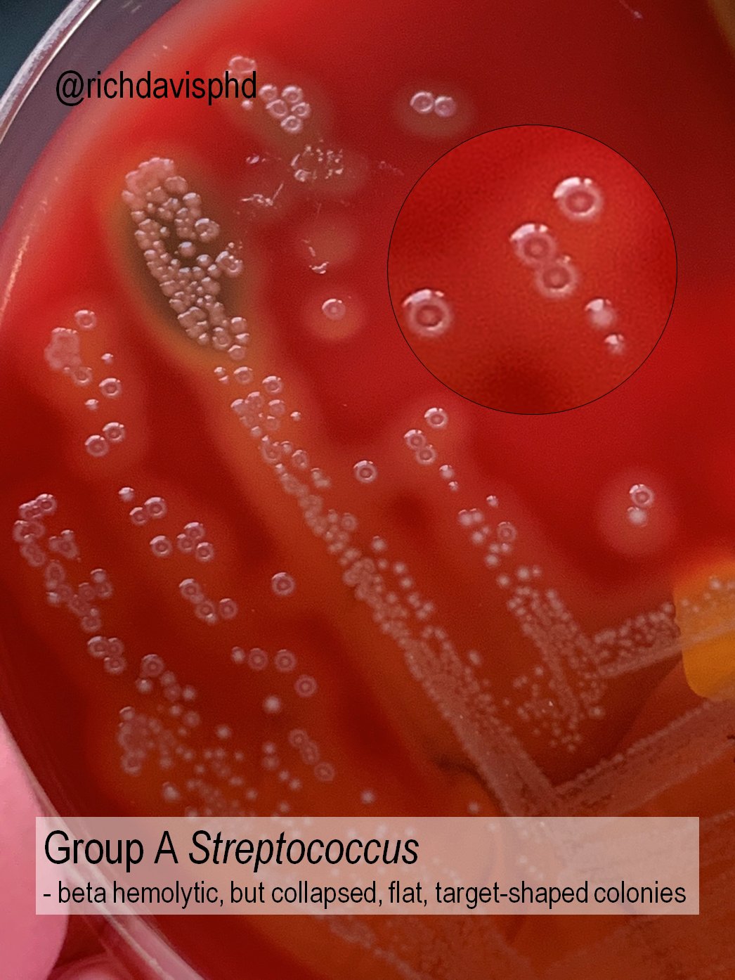 Streptococcus Pyogenes Colony Morphology