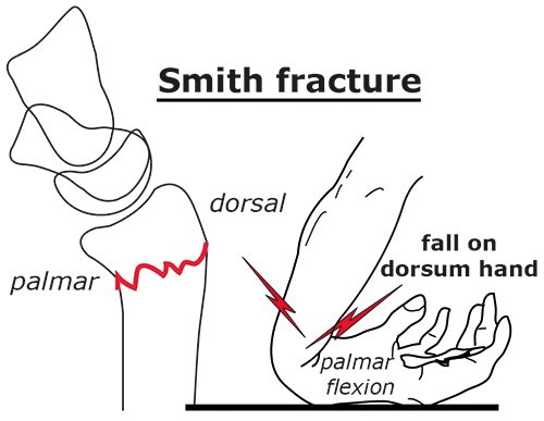 Smith Fracture Garden Spade