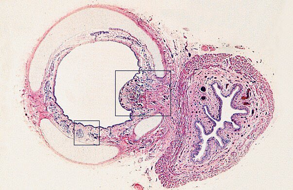 Esophagus And Trachea Histology Pathogenesis And Cells Of Origin Of