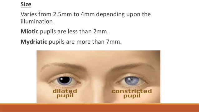 Miosis Vs Mydriasis