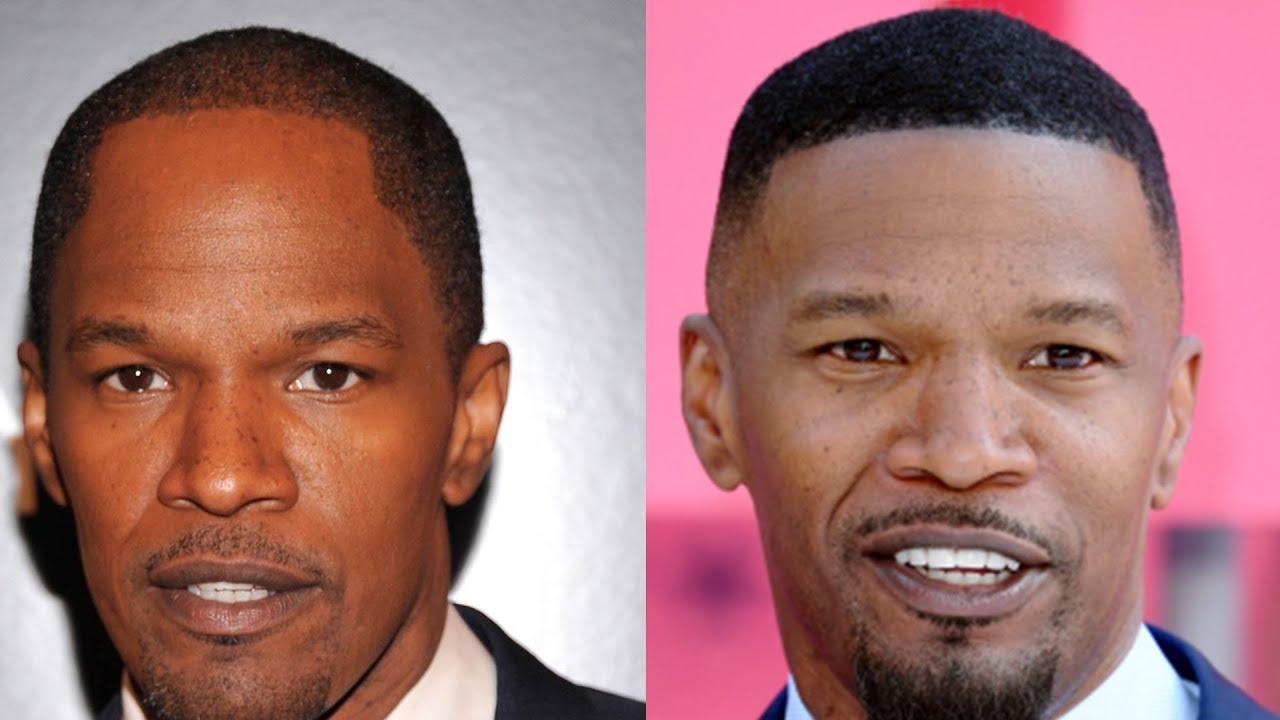 Jamie Foxx Hairline