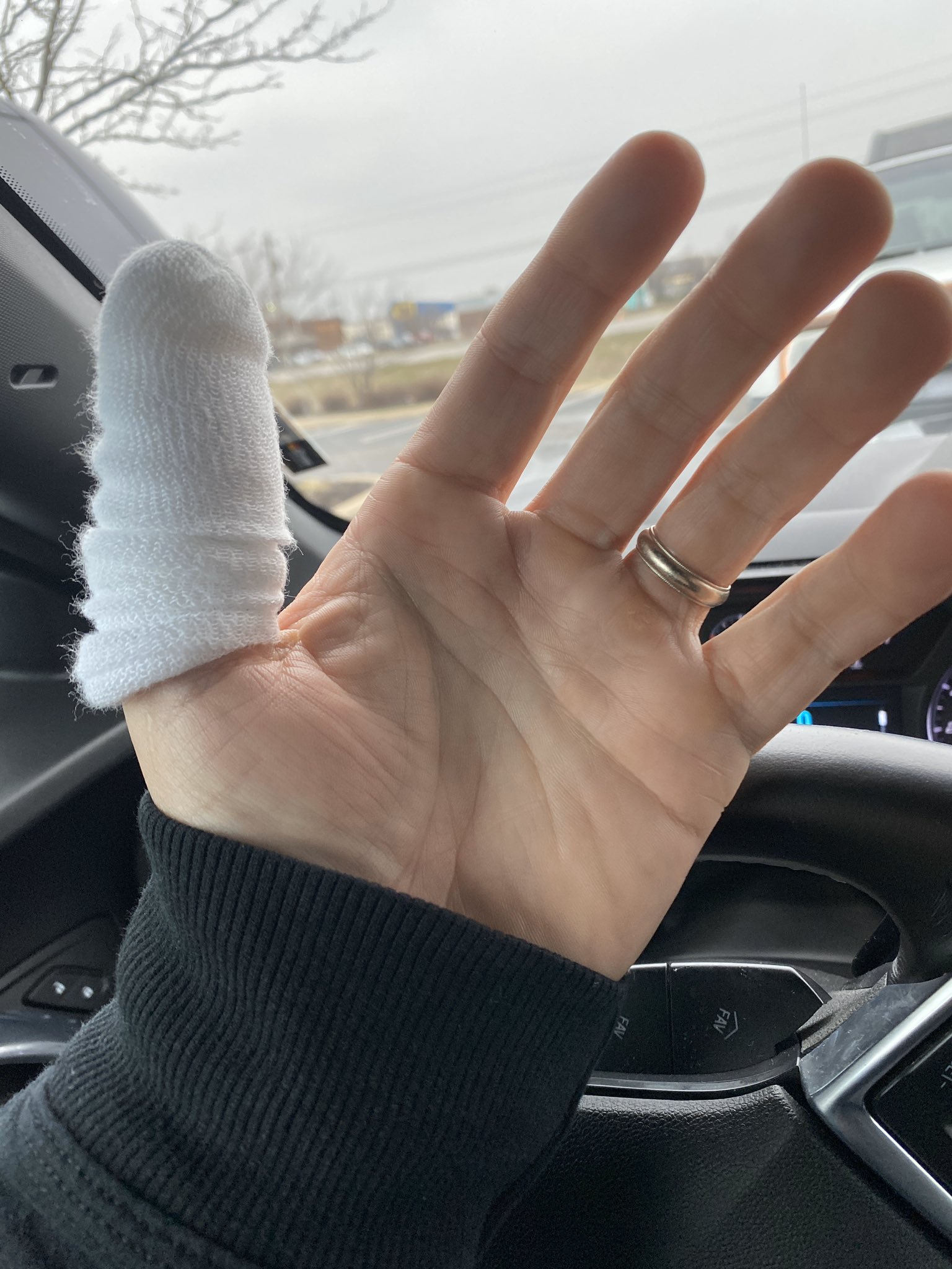 Swollen Thumb Joke Ups