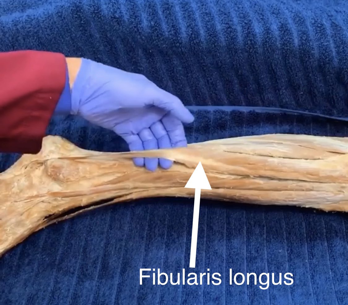 Fibularis Brevis Cadaver