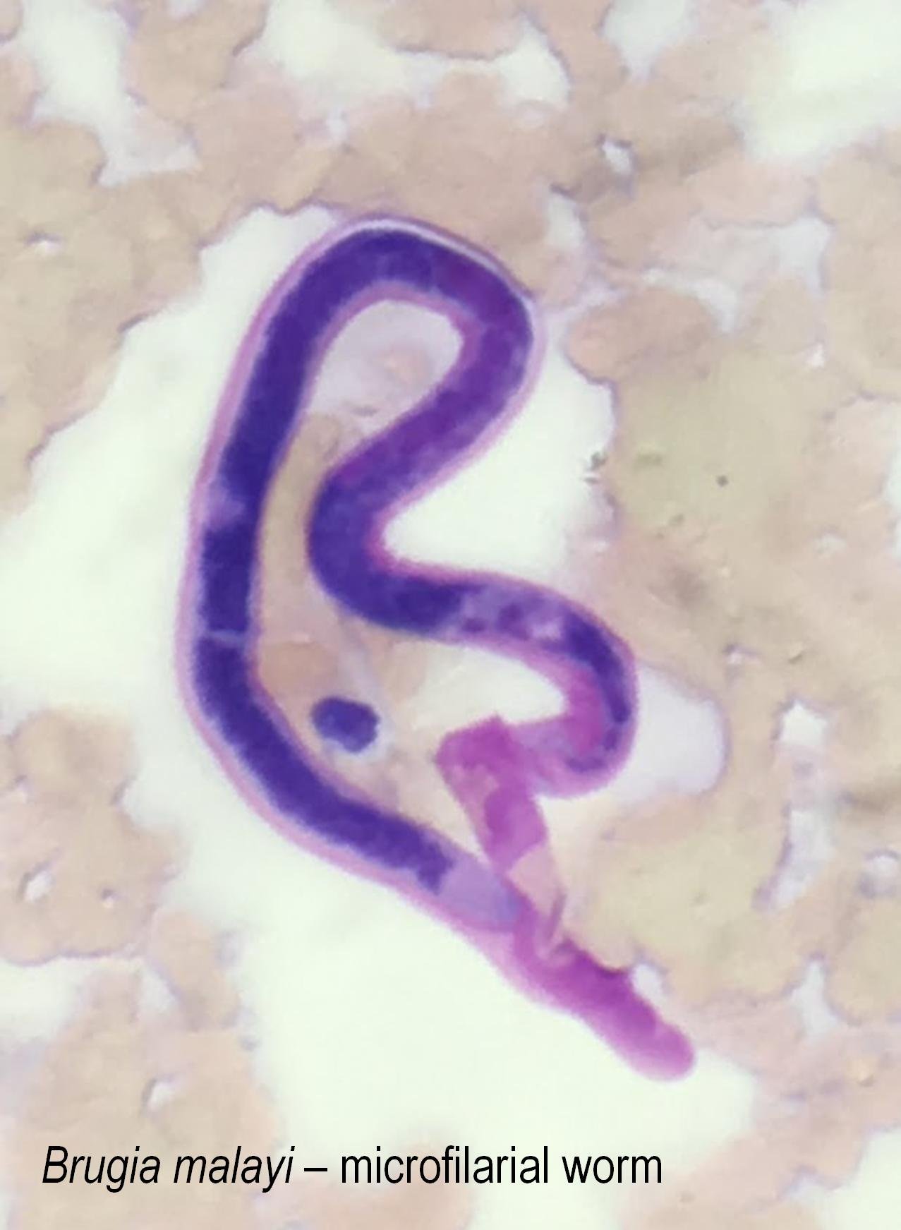 Brugia Malayi Microfilariae