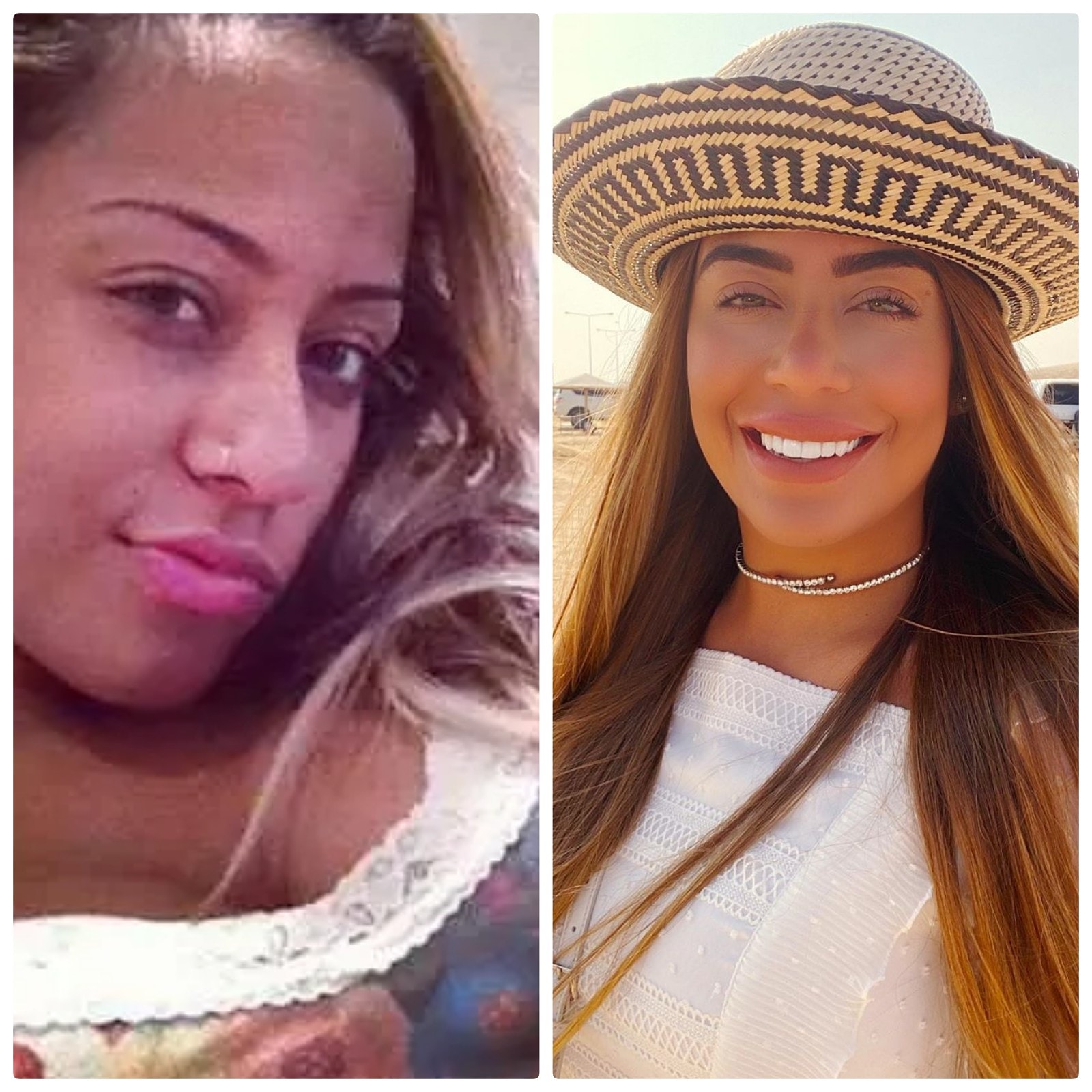 Rafaella Santos Antes E Depois Online | crescendocompetition.org