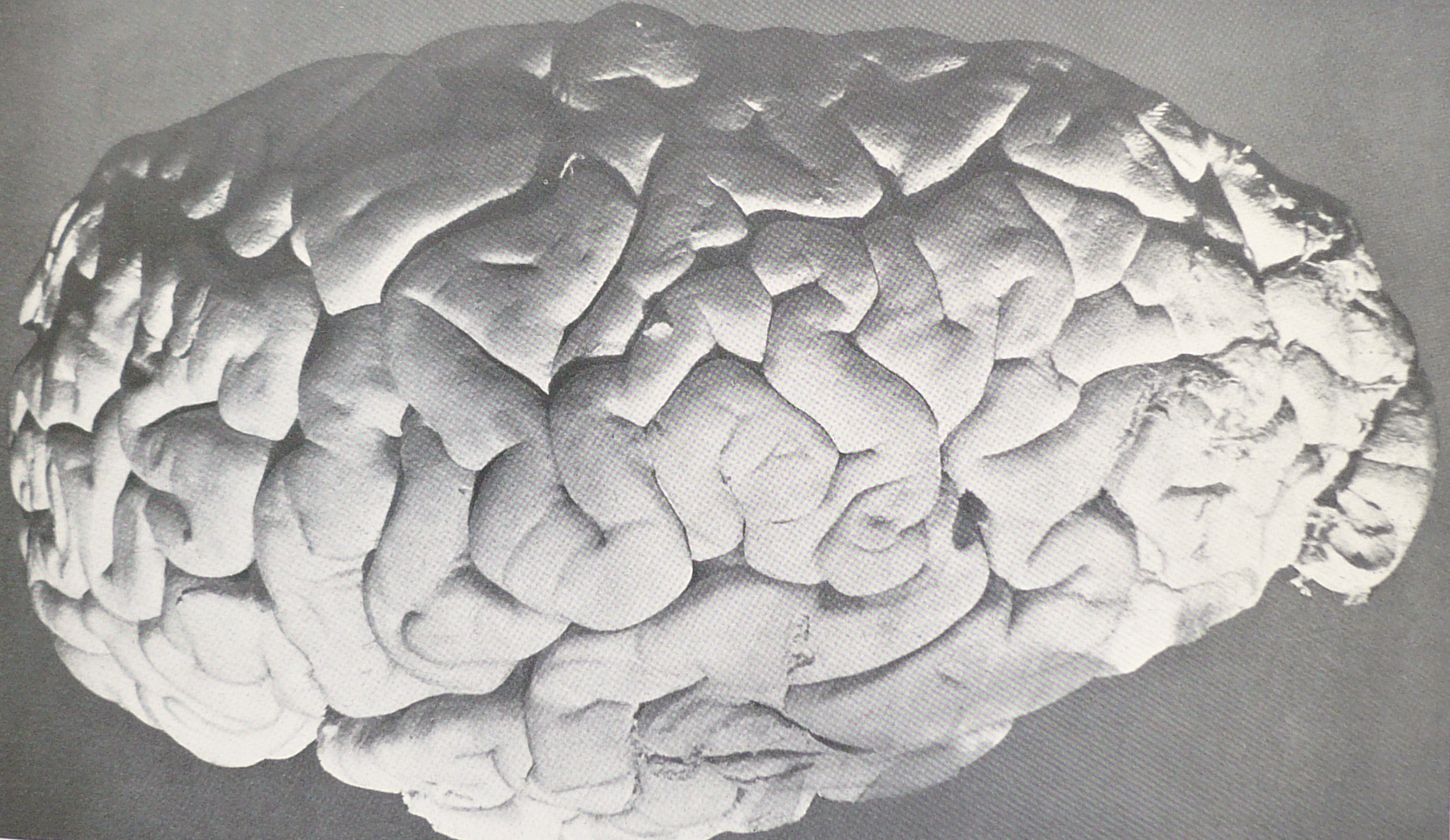 Charles Babbage Brain