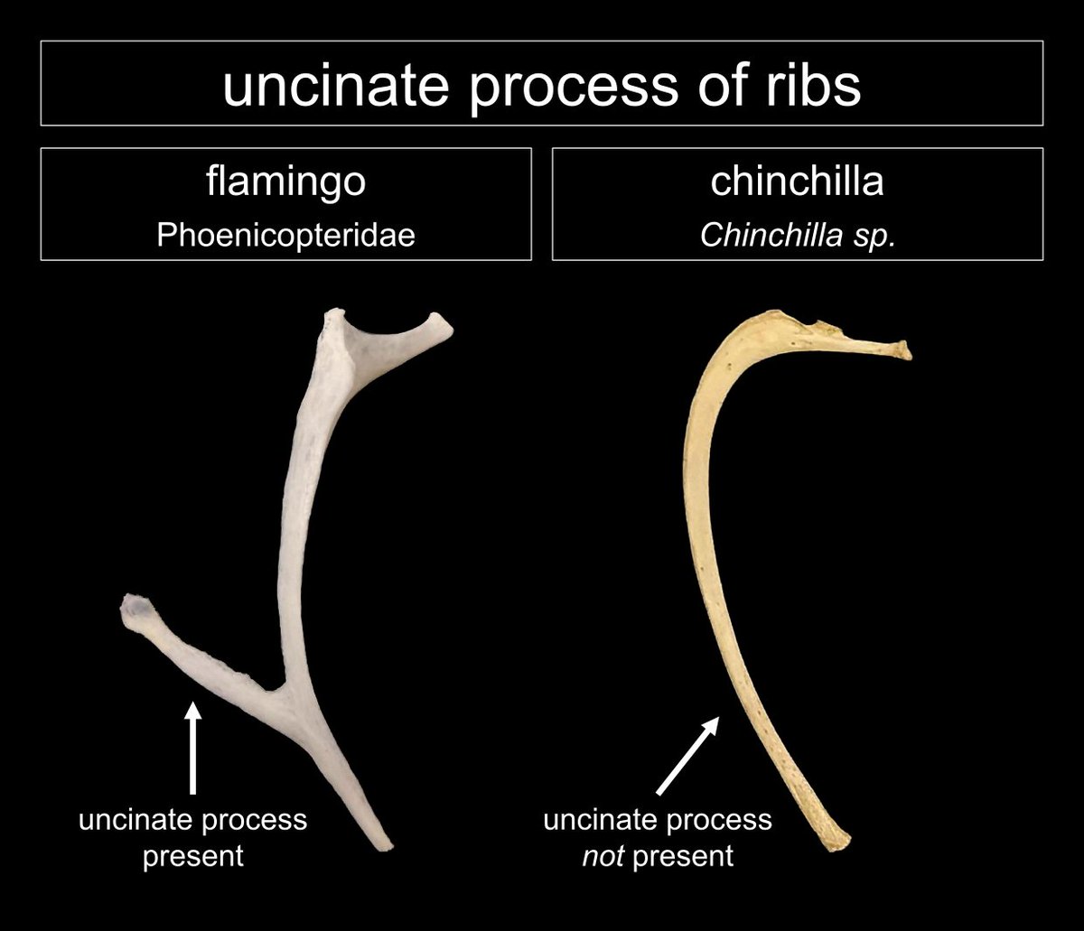 Uncinate Process Of Ethmoid Bone Wikidoc