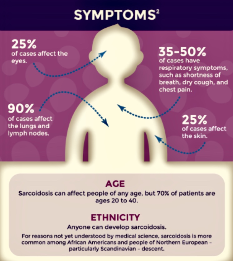 Sarcoidosis Skin African American