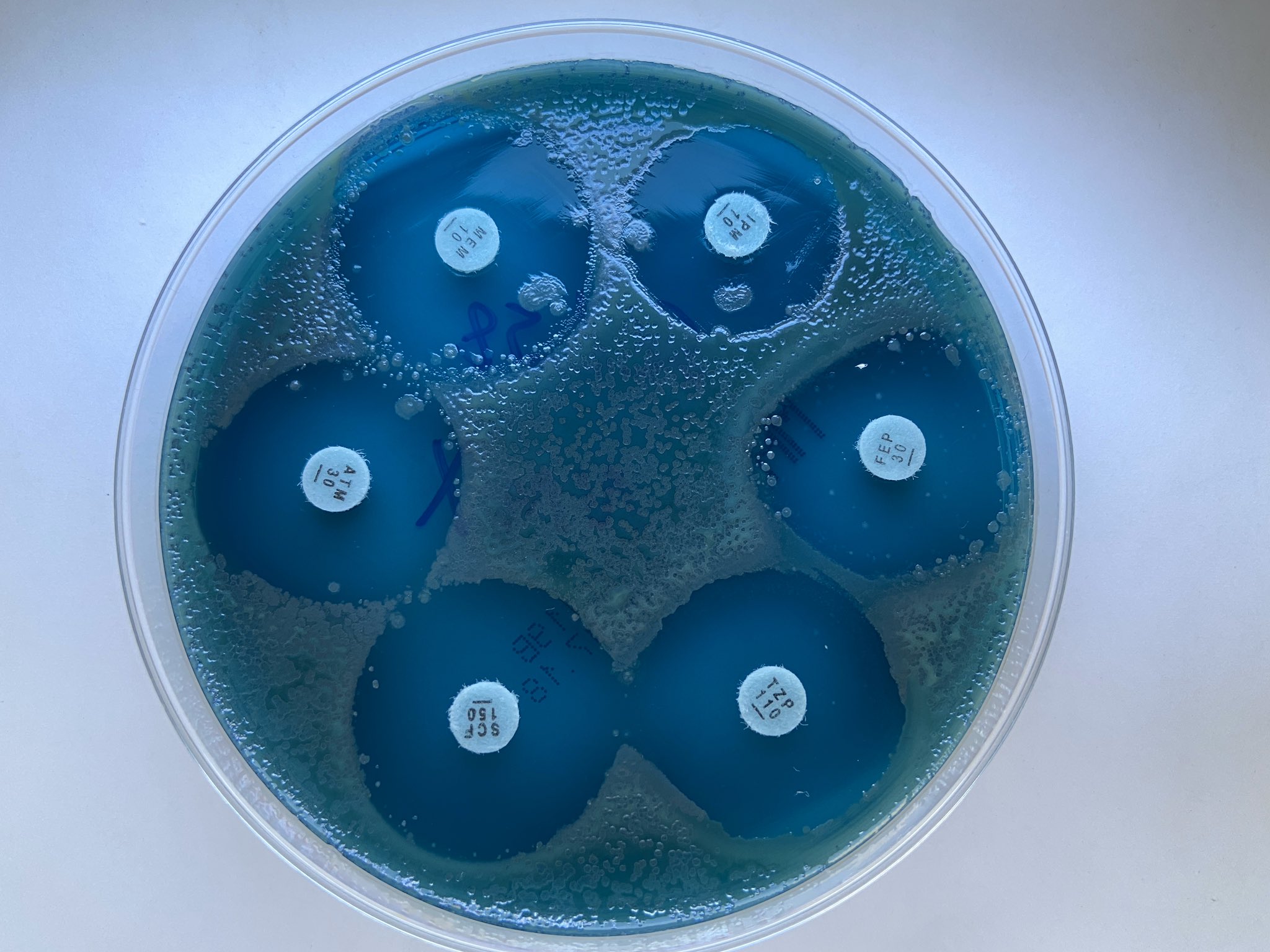 Pseudomonas Aeruginosa Culture