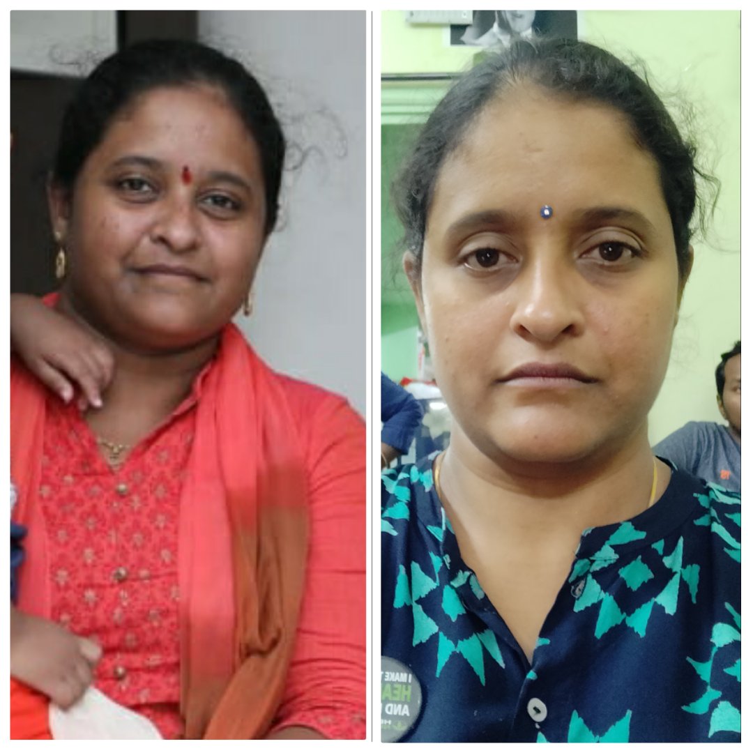 Herbalife Skin Booster, All Types Skin Problem Solution –, 58% OFF