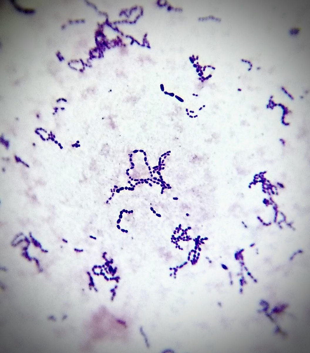 Streptococcus Pyogenes Gram Stain