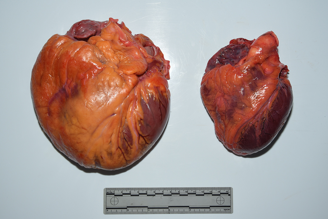 Enlarged Heart Compared To Normal Heart