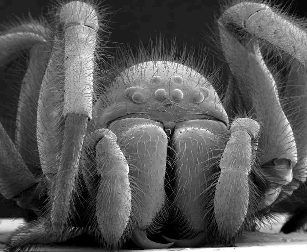 Spider Under A Microscope
