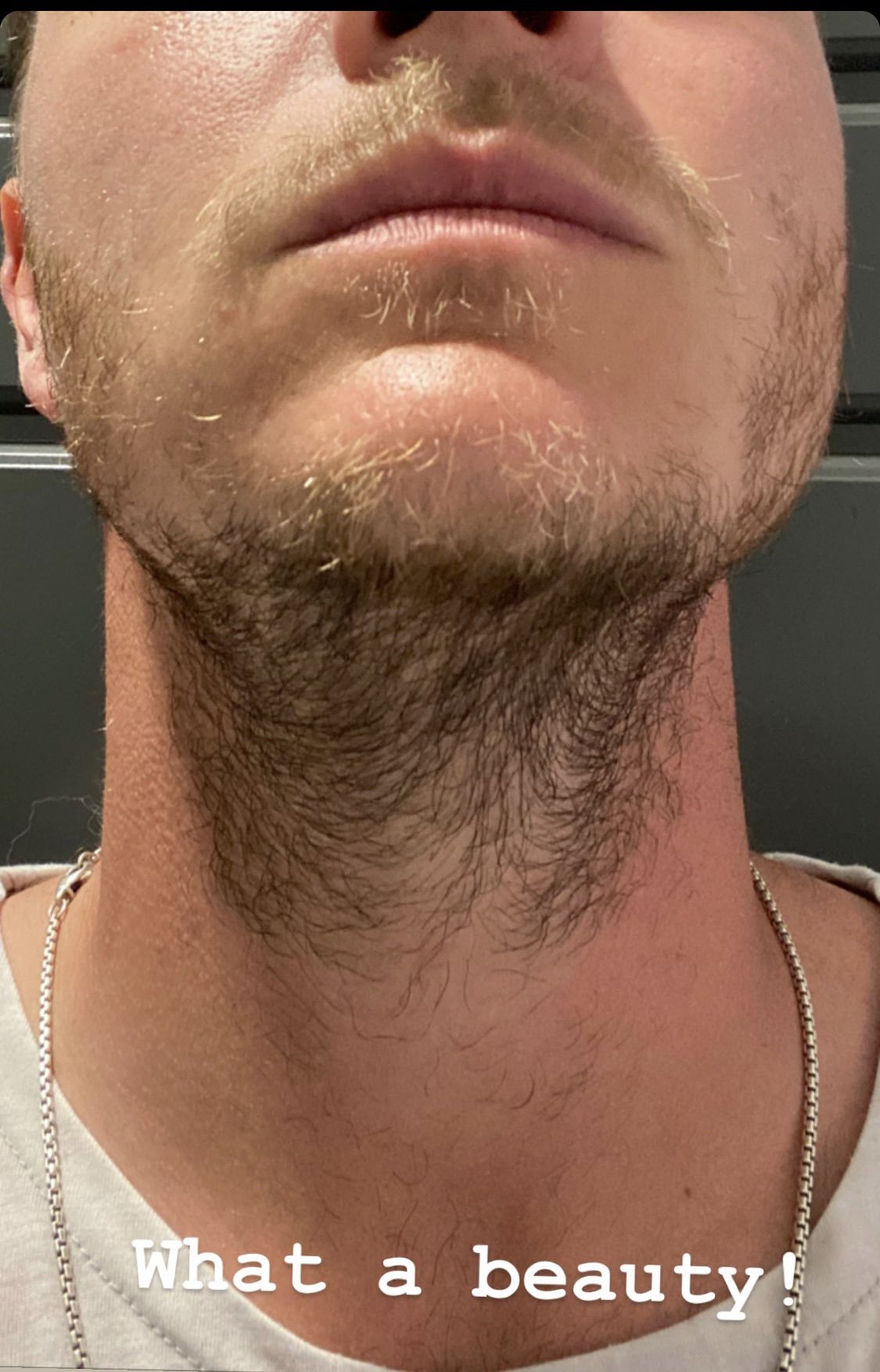 Gross Neck Beard