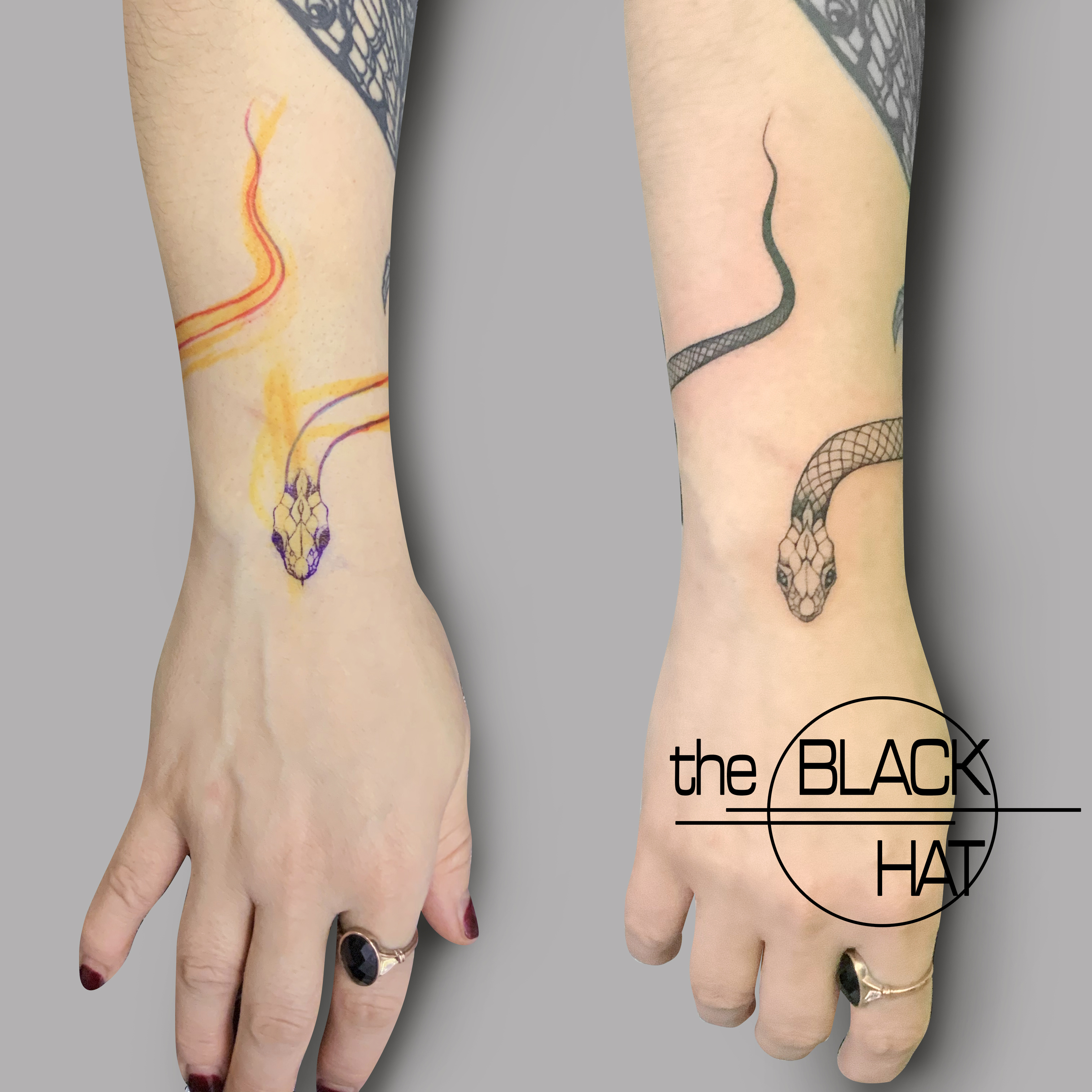 Medical Snake Tattoo