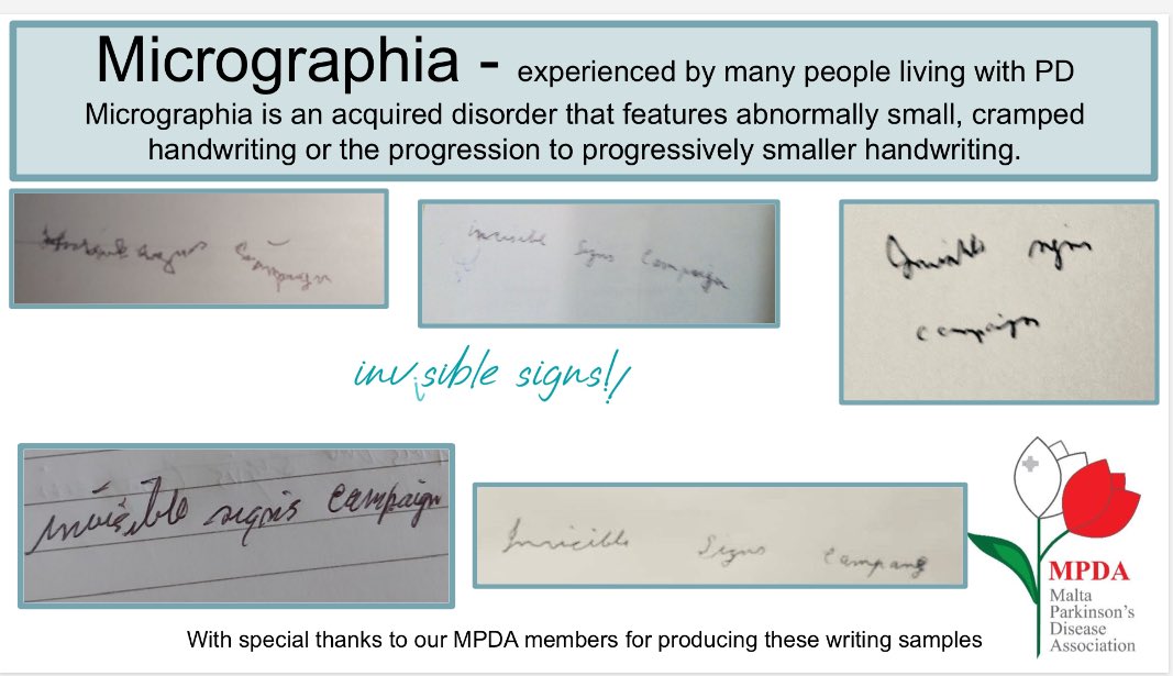 Micrographia Parkinson S Parkinson Disease Information | Mount Sinai