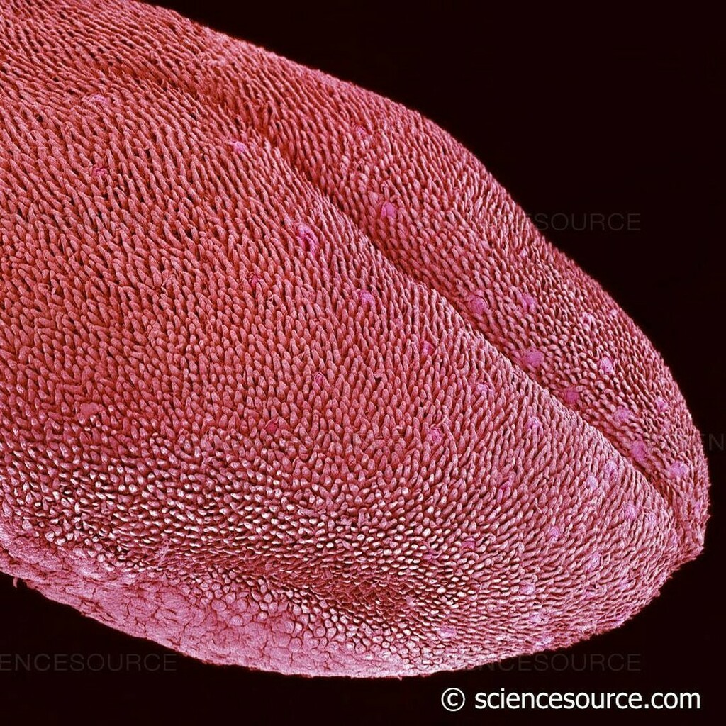 Filiform Papillae