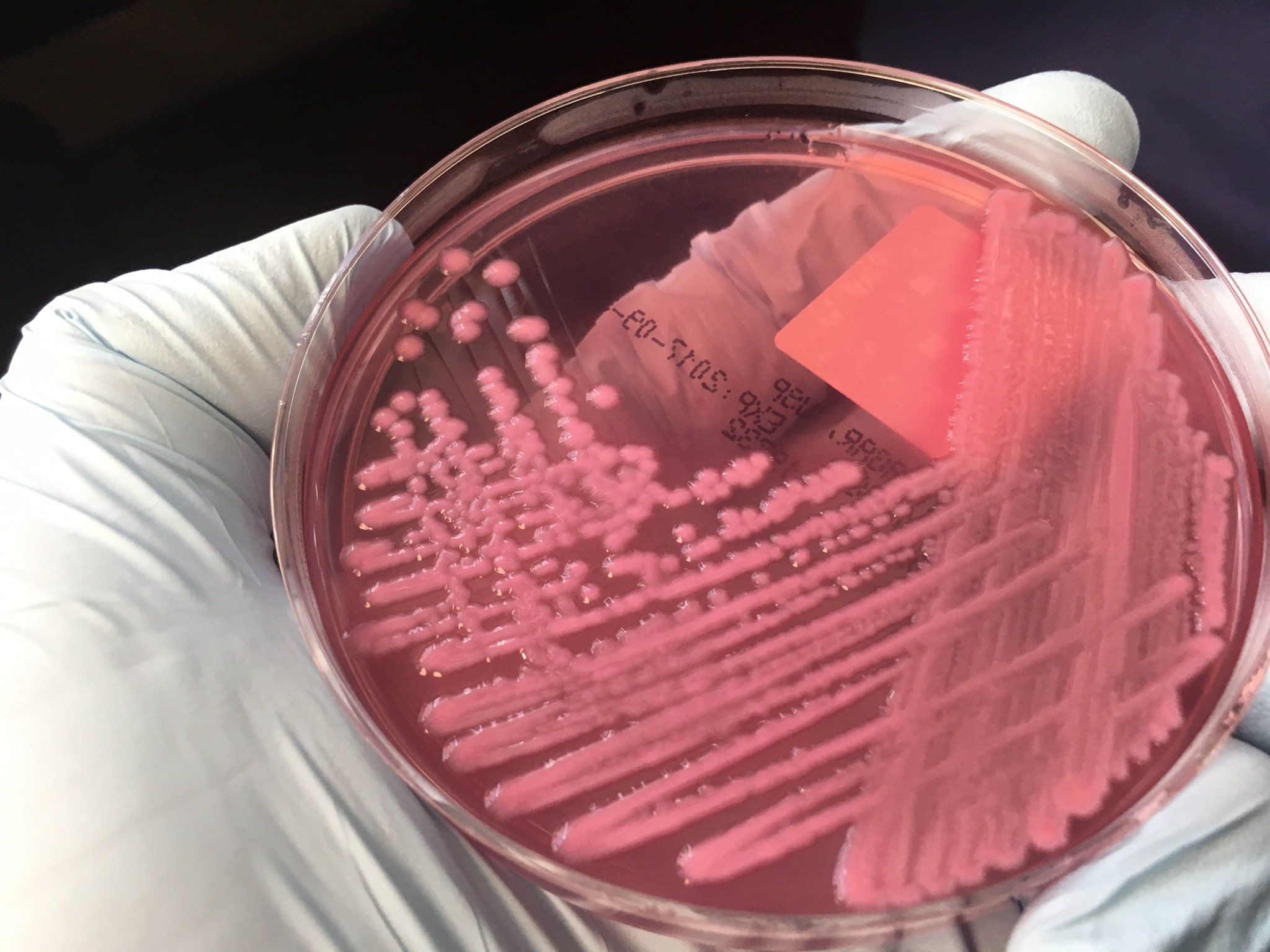 Macconkey Agar Lactose Fermentation