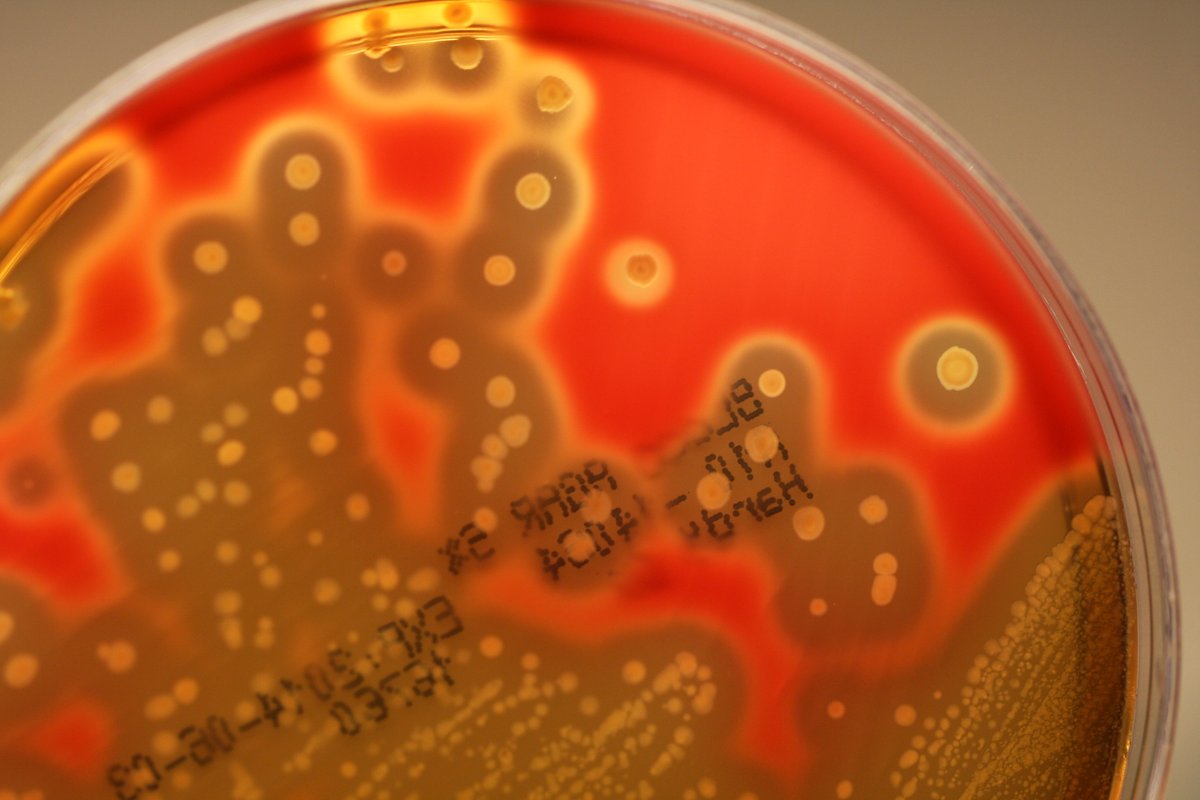 Blood Agar Streptococcus Pyogenes