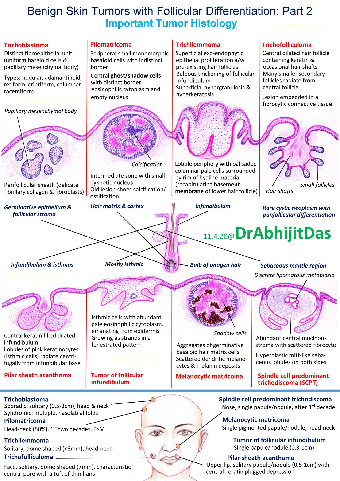 Skin Tumor Histology