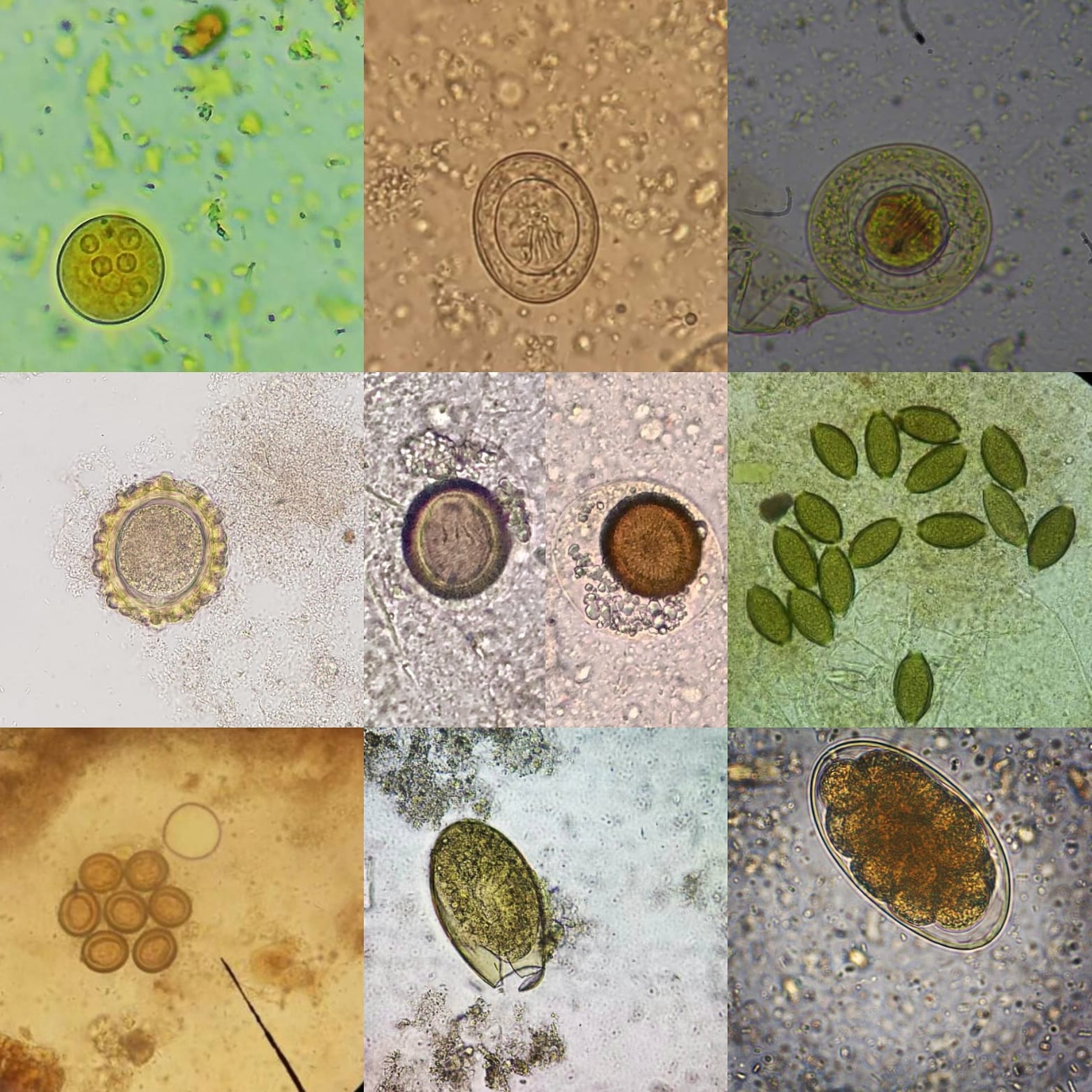 Entamoeba Coli Trofozoito