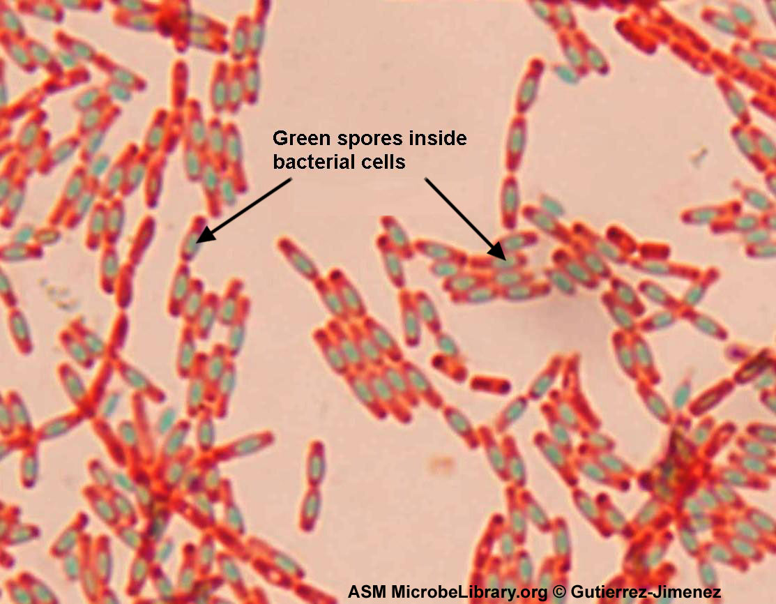 Bacillus Subtilis Spore Stain