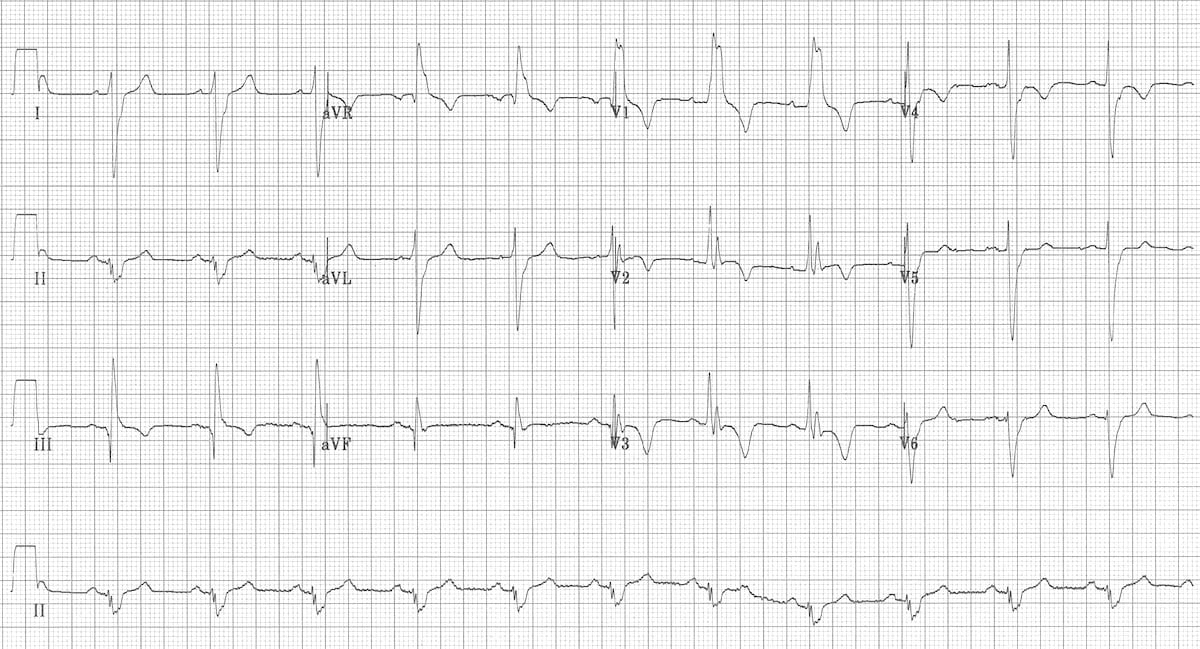 Thread By @RosenelliEM - This thread reviews sudden cardiac...