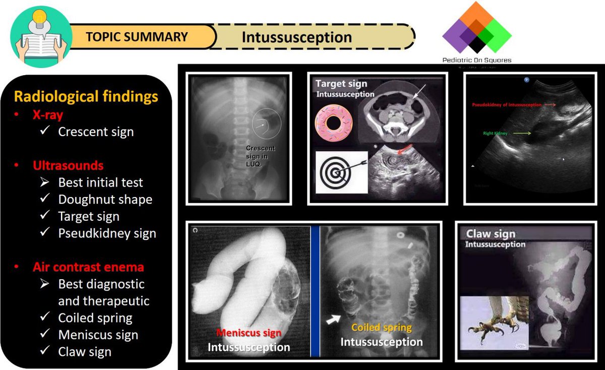 Intussusception X Ray