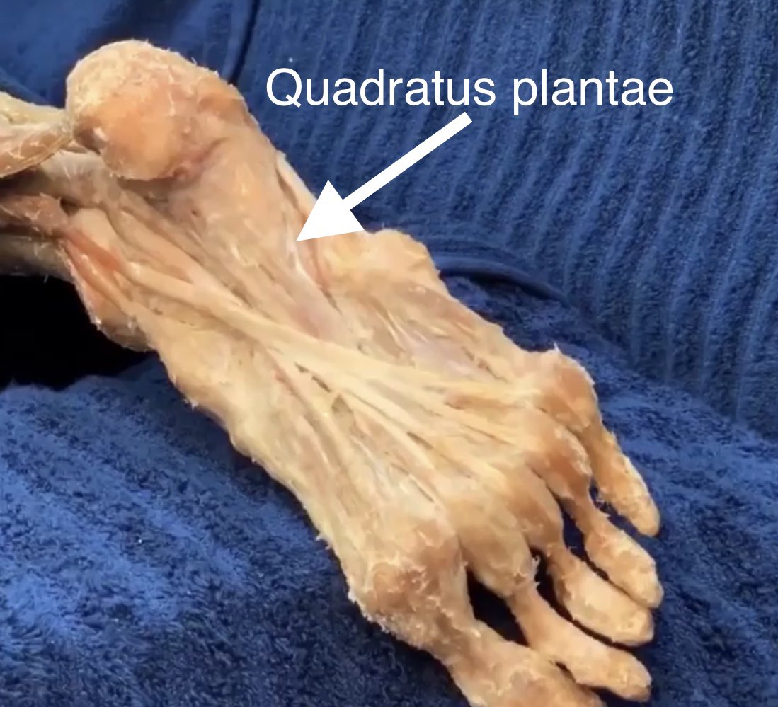 Quadratus Plantae Foot