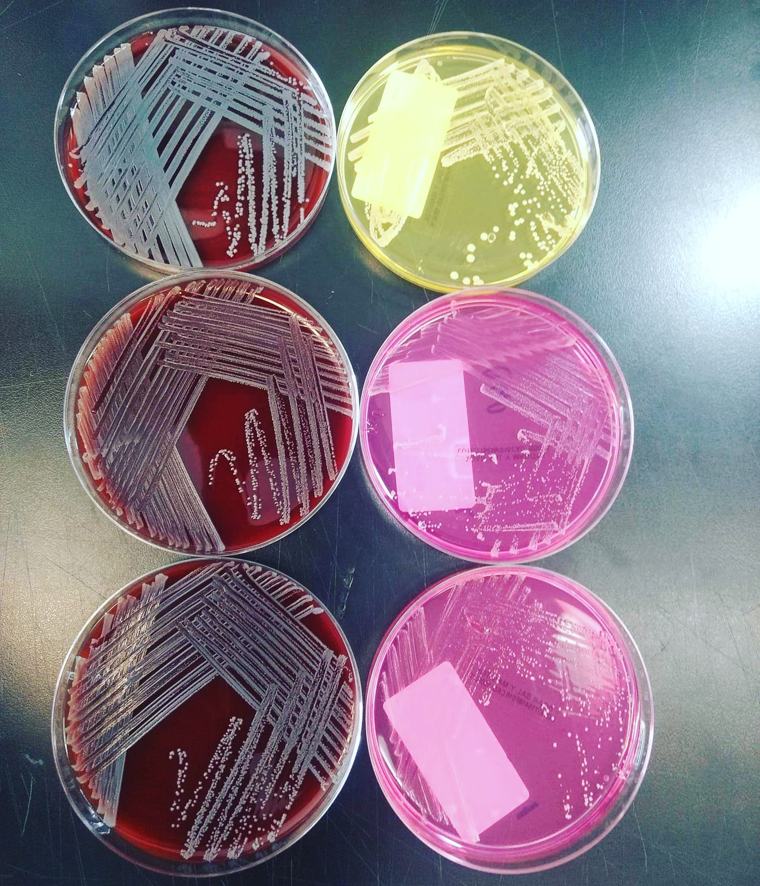 Staphylococcus Epidermidis Agar Plate