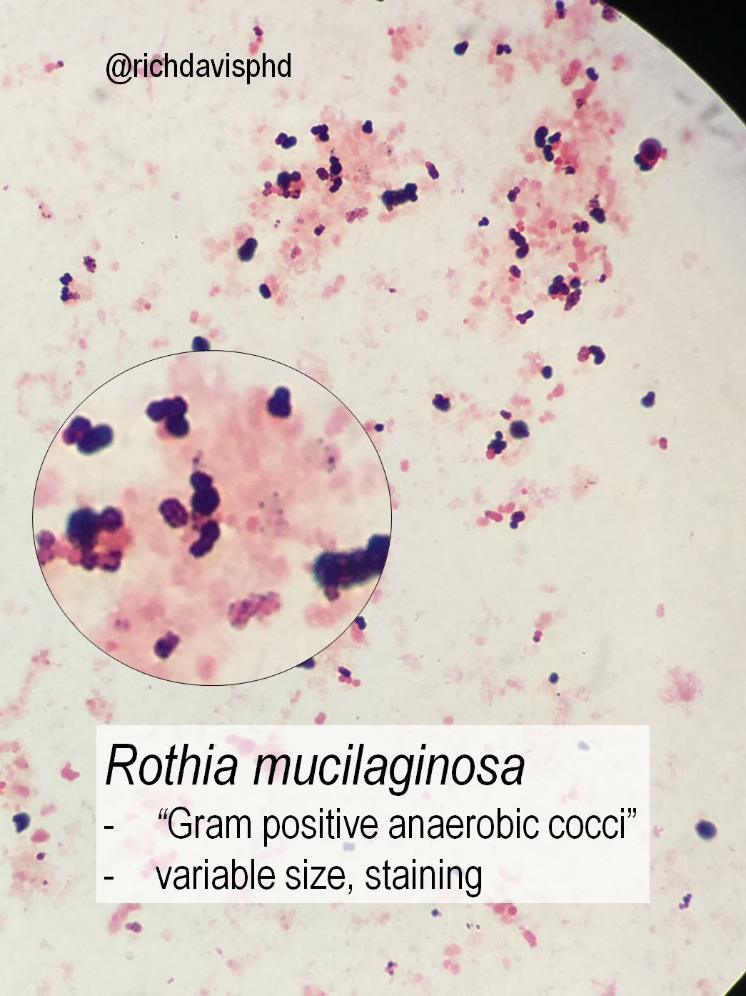 Moraxella Catarrhalis Gram Stain