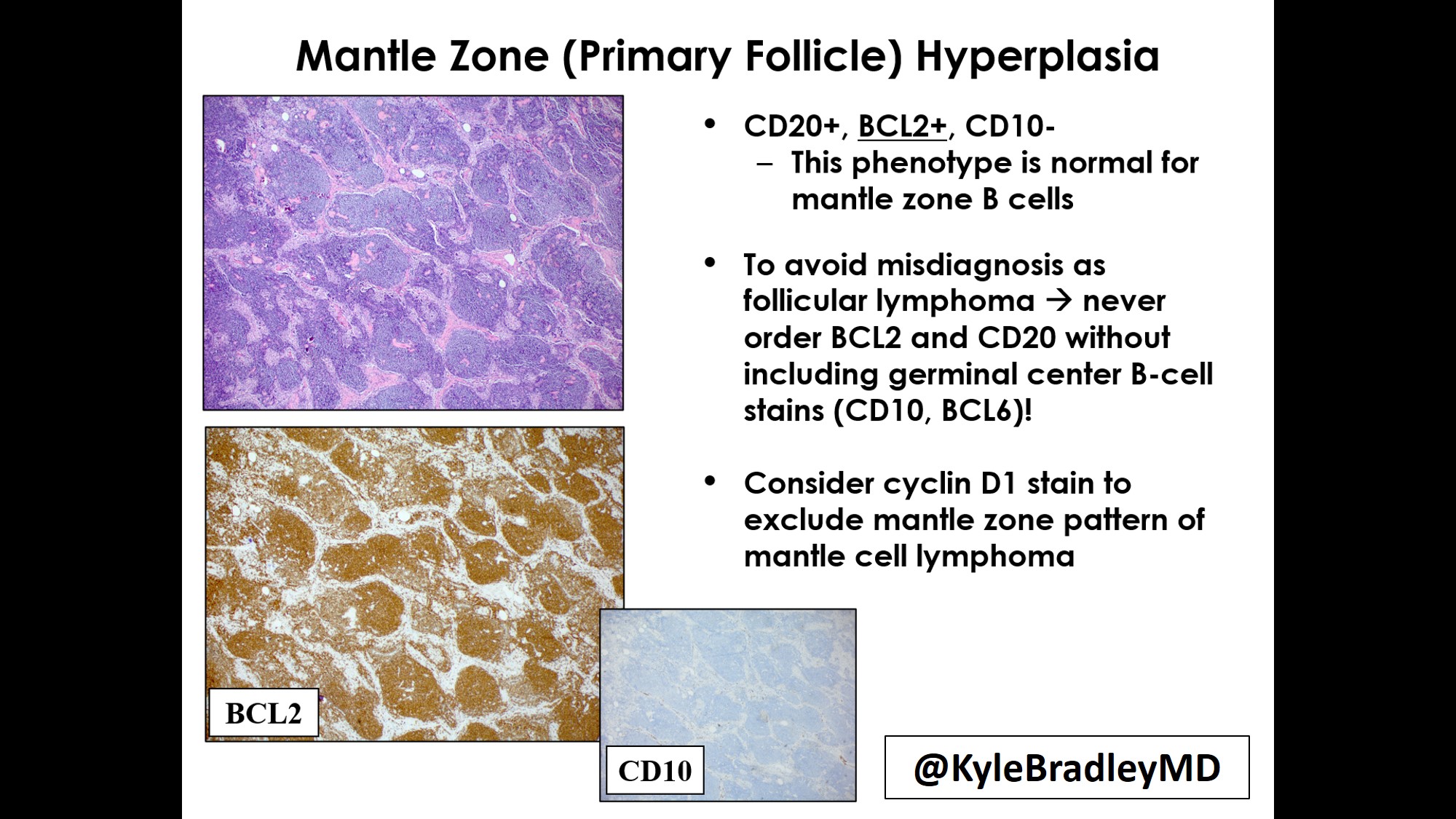 Primary Follicle