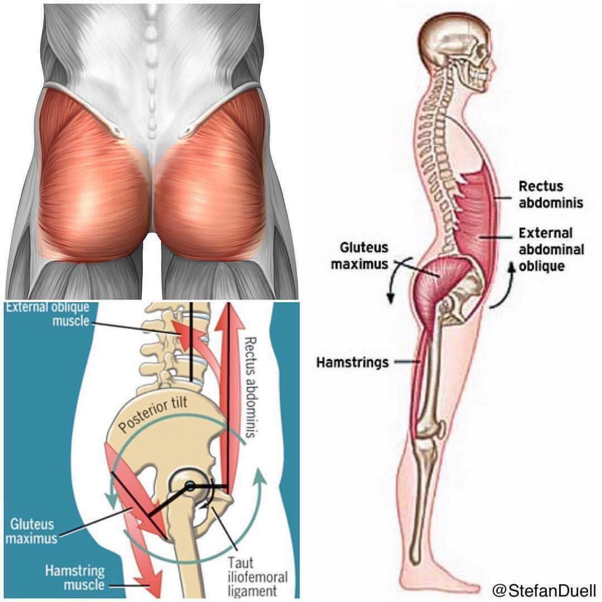 Gluteus Medius Pain At Iliac Crest