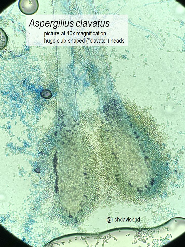 Aspergillus Slide Labeled
