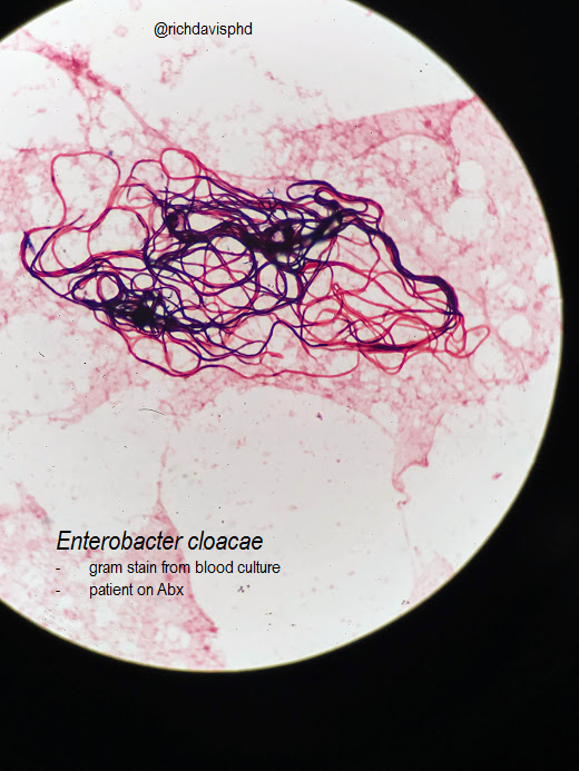Enterobacter Cloacae Gram Stain