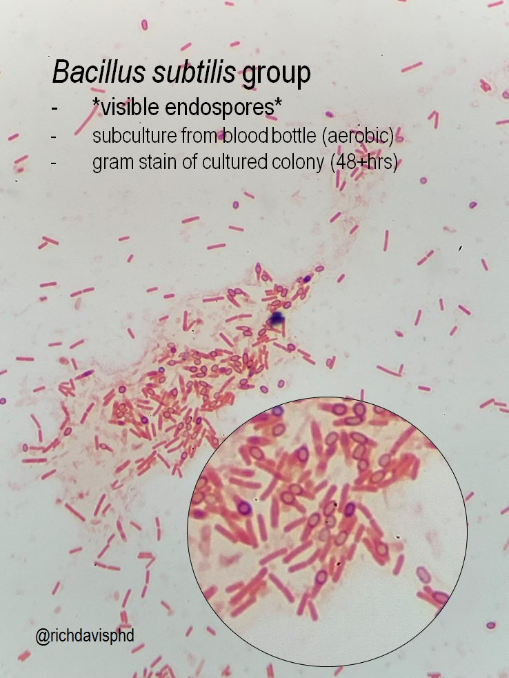 Bacillus Subtilis Gram Stain Positive Or Negative