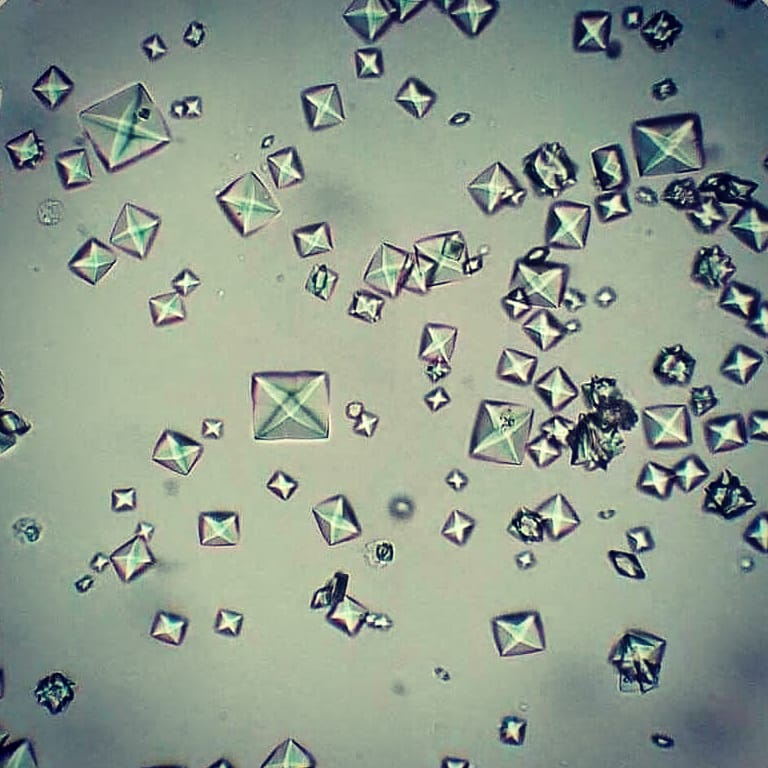 Cristales De Oxalato De Calcio