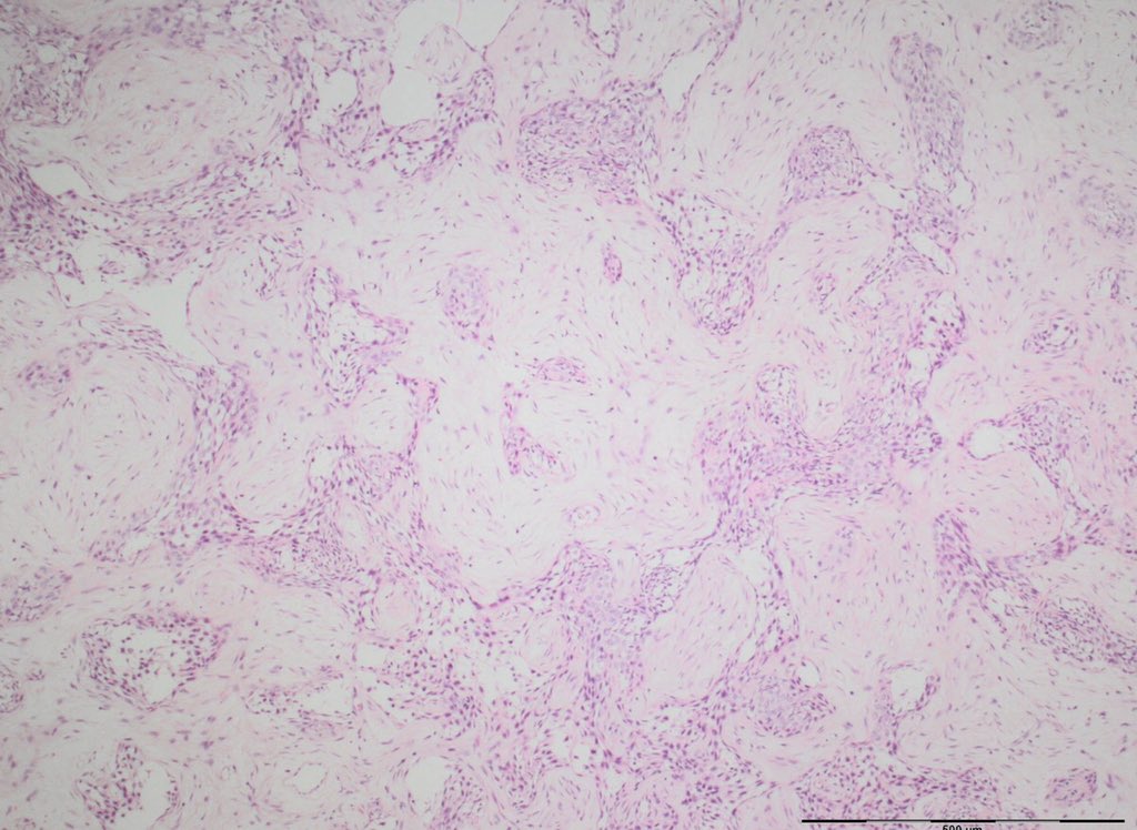 #msk #musculoskeletal #Radiology #MSK #orthopedics #orthotwitter Here a ...