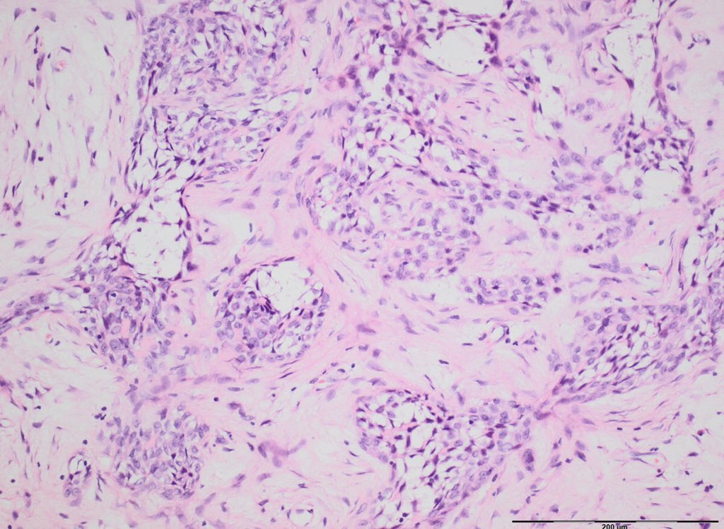 #msk #musculoskeletal #Radiology #MSK #orthopedics #orthotwitter Here a ...