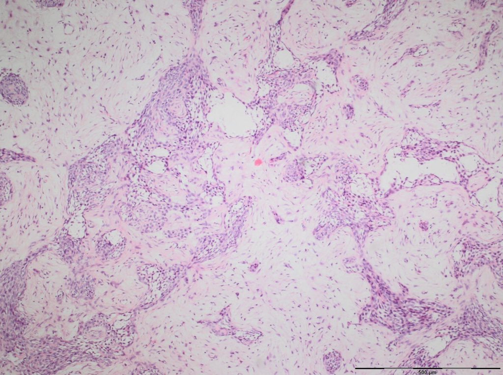 #msk #musculoskeletal #Radiology #MSK #orthopedics #orthotwitter Here a ...