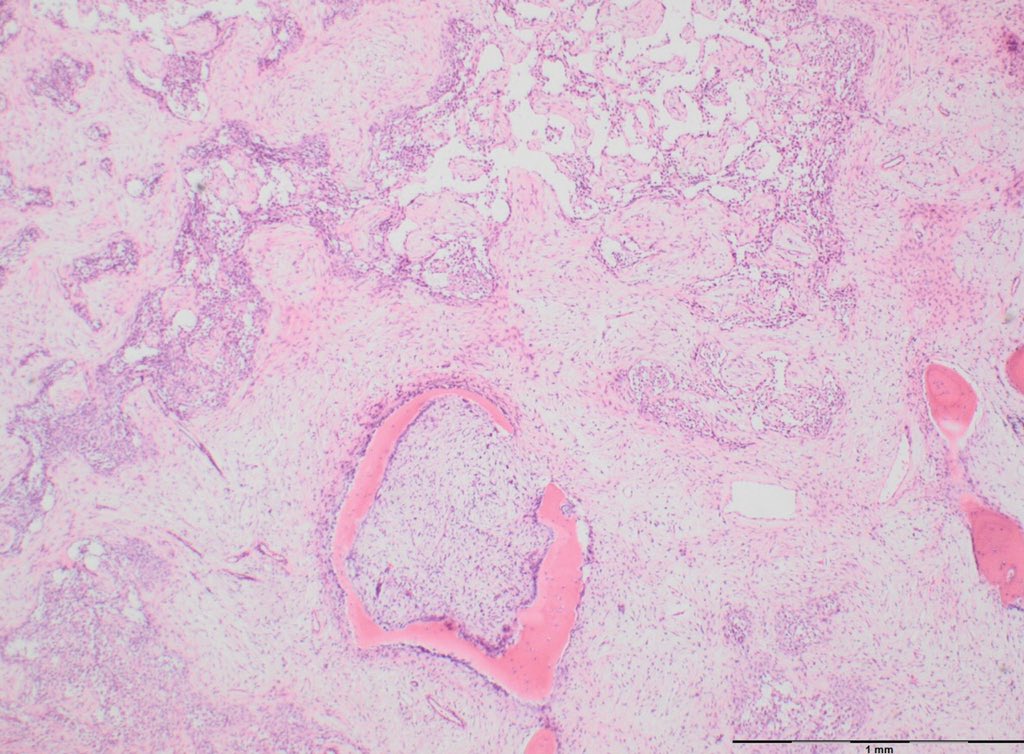 #msk #musculoskeletal #Radiology #MSK #orthopedics #orthotwitter Here a ...